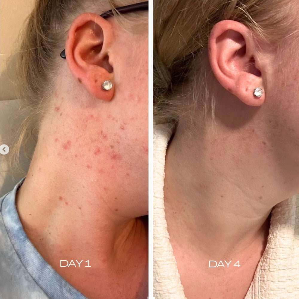 Hormone Check Drops by Eyeam – eyeam