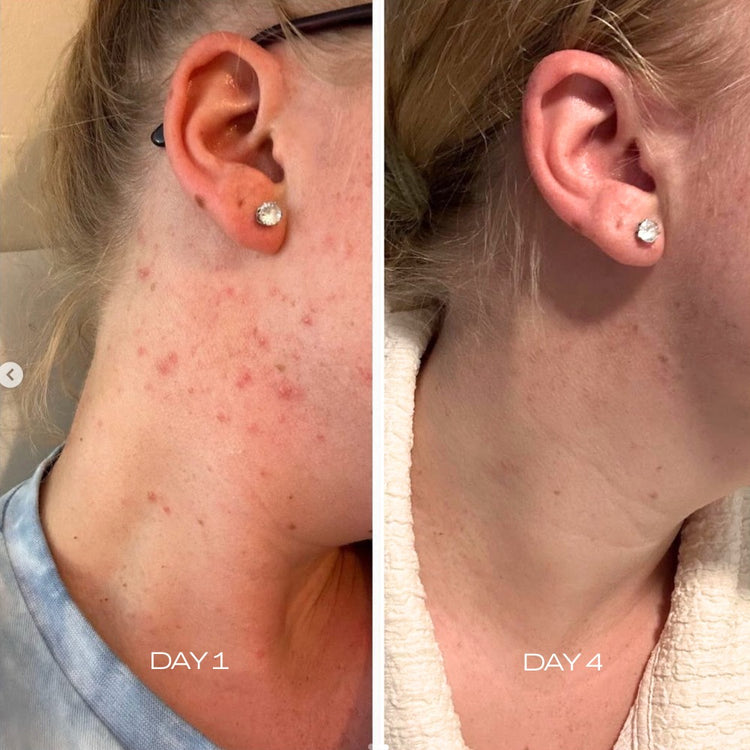 Hormone Check Drops by Eyeam – eyeam