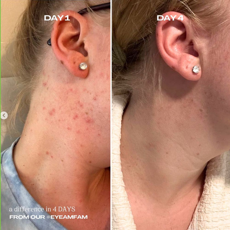 Hormone Check Drops by Eyeam – eyeam