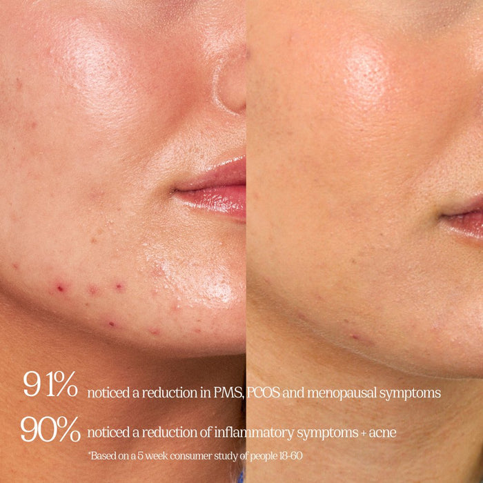 Hormone Check Drops by Eyeam – eyeam