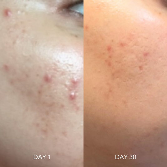 Natural spot and acne treatment cream with crystal elixir – eyeam