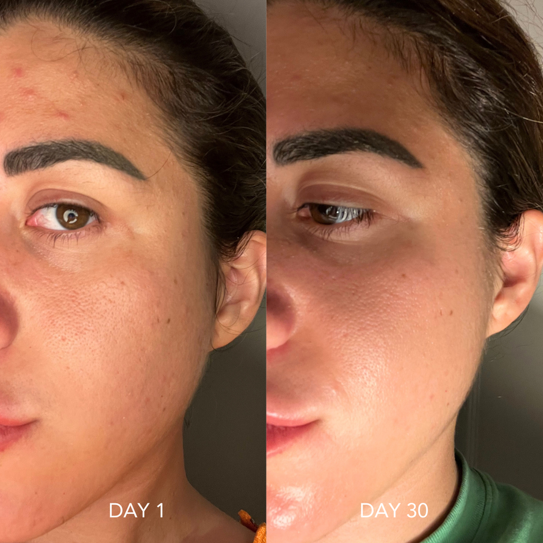 Homeopathic natural hormone balancing drops – eyeam