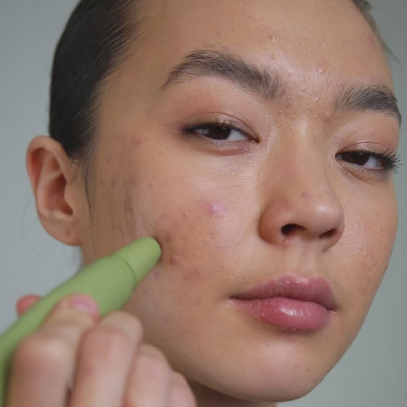 Natural spot and acne treatment cream with crystal elixir – eyeam